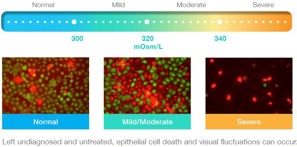Tearlab® Labtician Ophthalmics