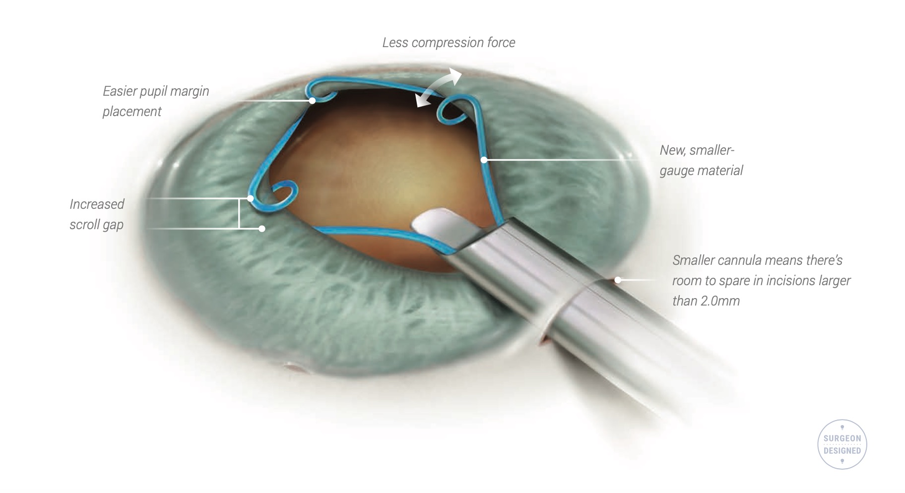 6.25MM MST MALYUGIN RING 2.0 - Labtician Ophthalmics